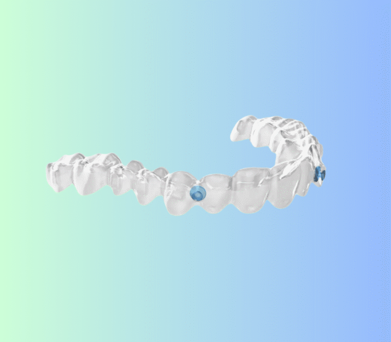 Angel Aligner (Singapore): Invisible Braces for Asian Teeth