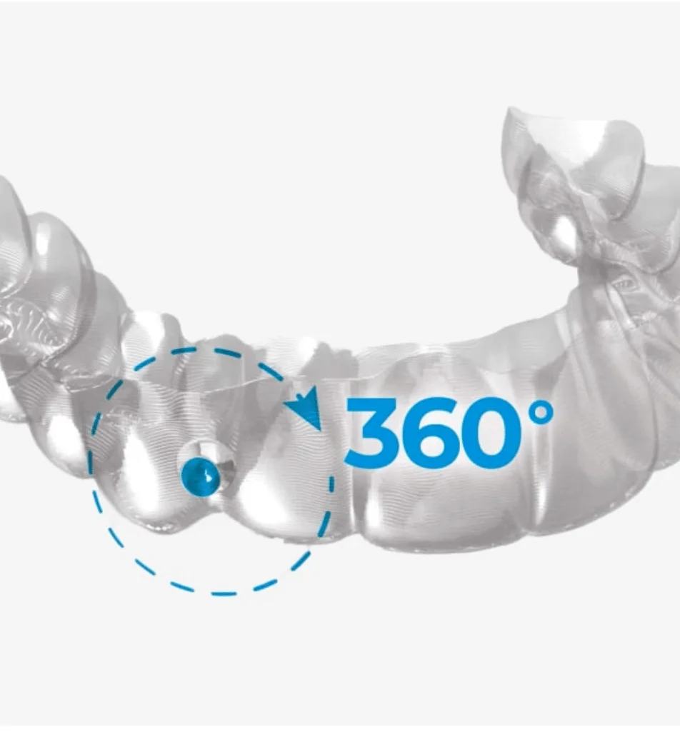 Our Technology: Smile Innovation → Angel Aligner Singapore